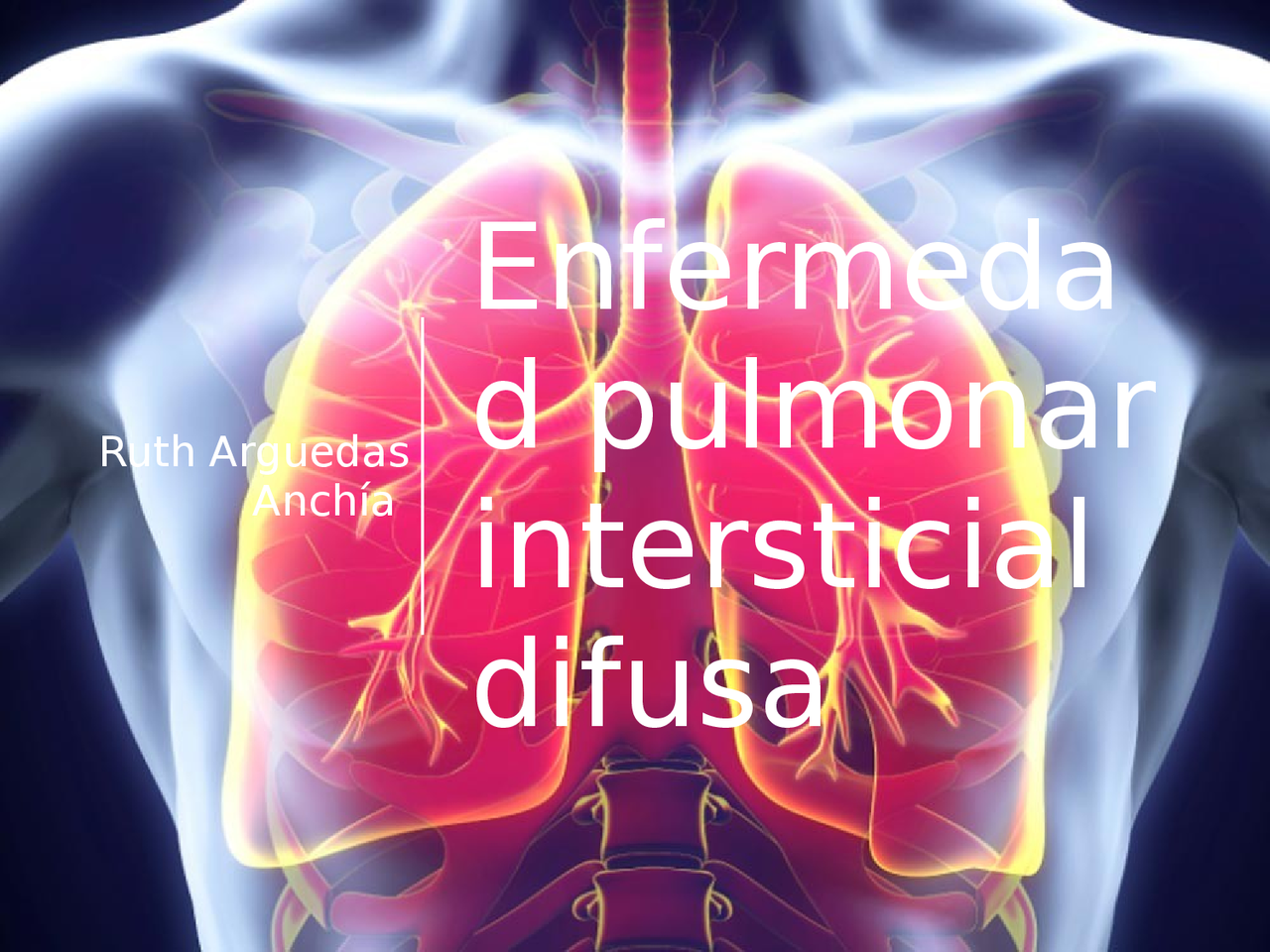 Enfermedad pulmonar intersticial difusa - Docsity