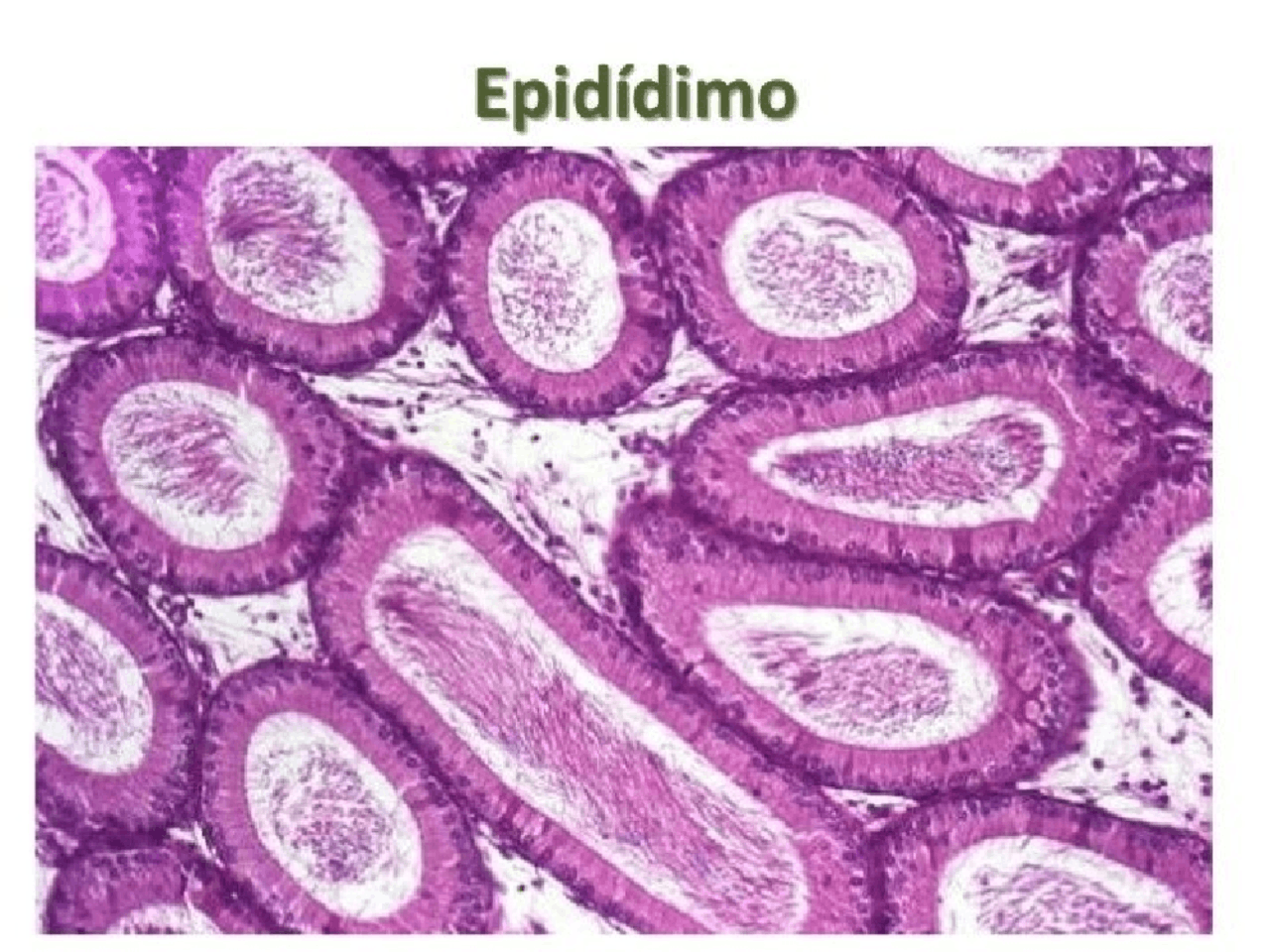 Epididimo corte transversal | Diapositivas de Histología | Docsity