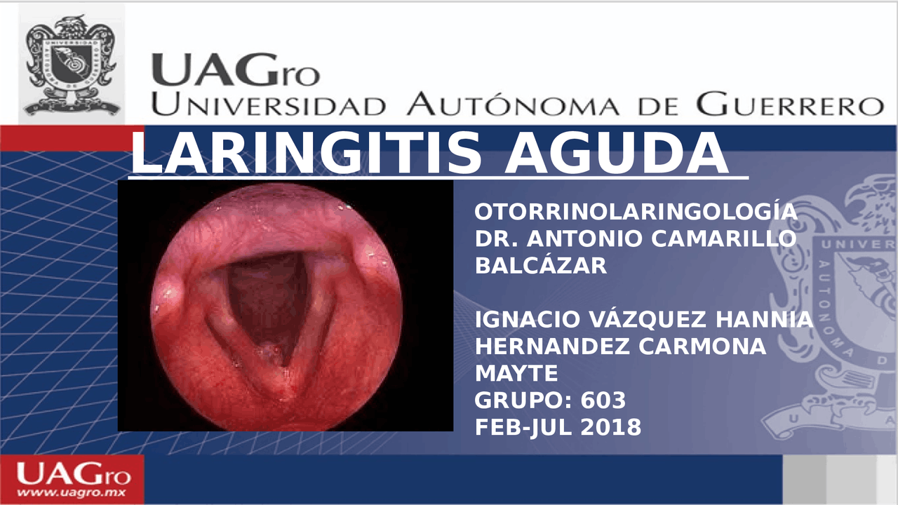MANEJO DE LARINGITIS AGUDA - Docsity