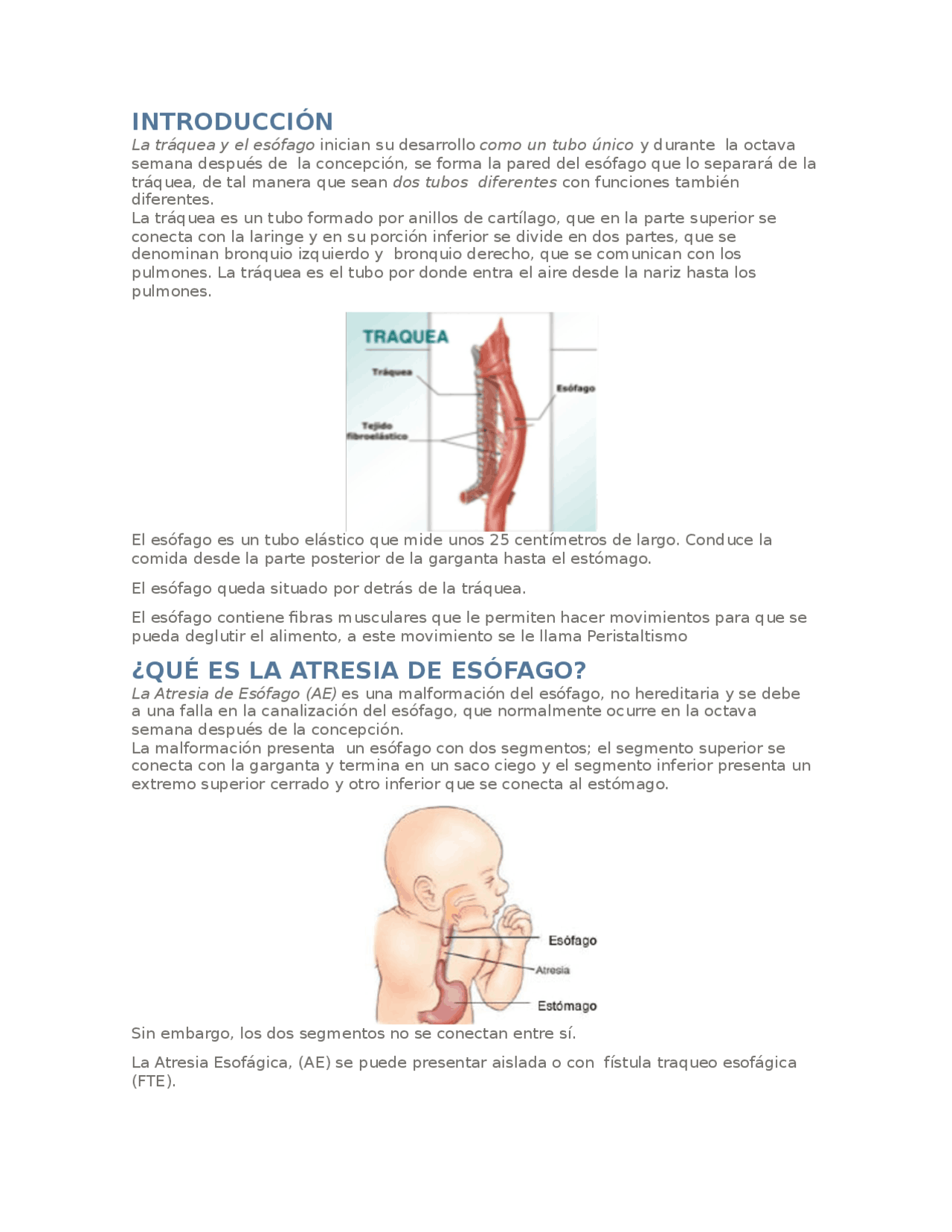 Atresia esofagica con fistula traqueoesfagica - Docsity