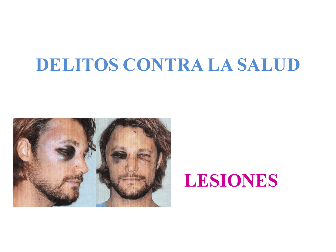 Delito de lesiones en el Código Penal Español - Docsity