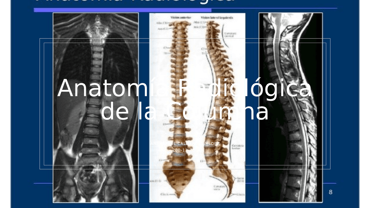 Anatomia de Columna RX - Docsity