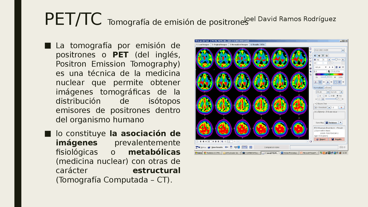 Resumen de tomografía por emisión de positrones. - Docsity