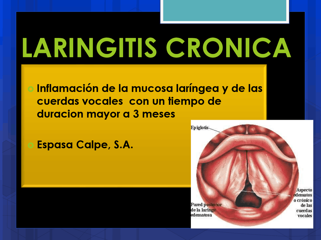Laringitis cronica presentacion | Diapositivas de Otorrinolaringología ...