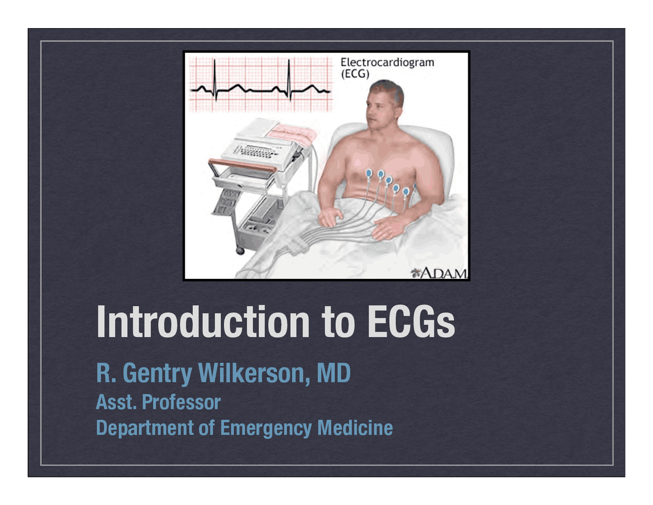Basics of ECG learning - Docsity