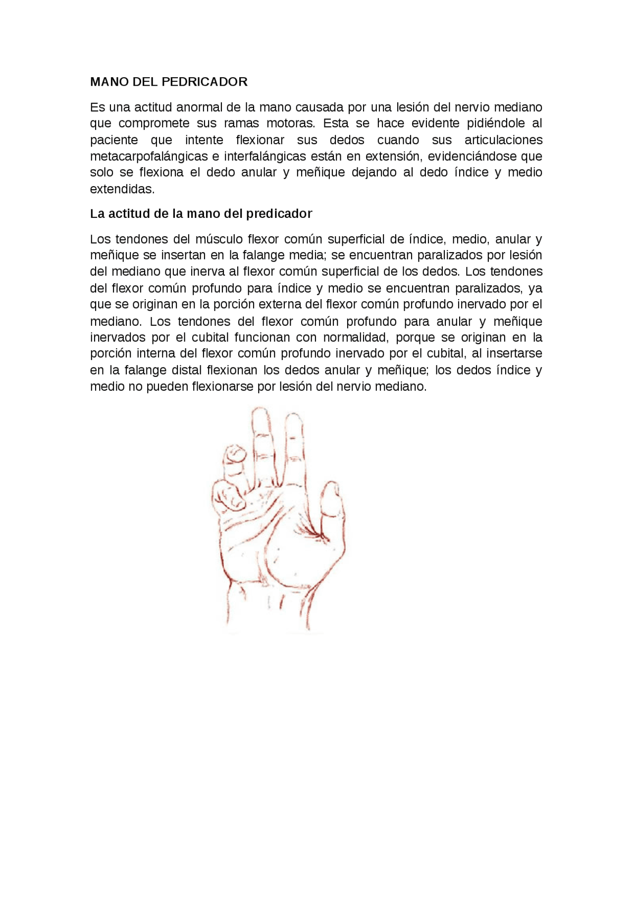 MANO DEL PREDICADOR CLÍNICA | Resúmenes de Anatomía | Docsity