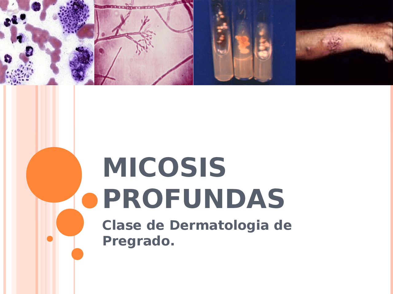 Micosis Profundas - Resumen | Diapositivas de Dermatología | Docsity