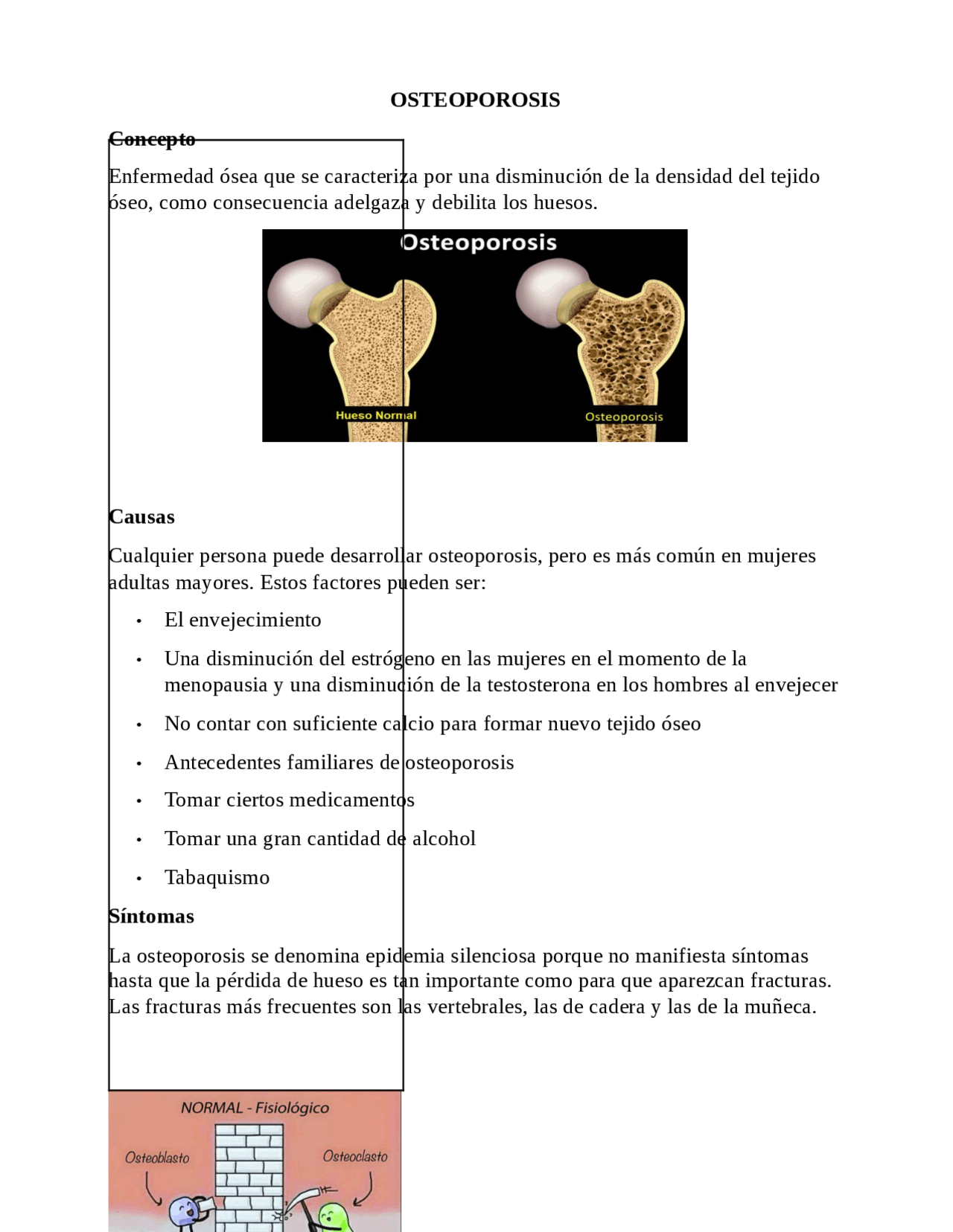 Enfermedad Osteoporosis Docsity
