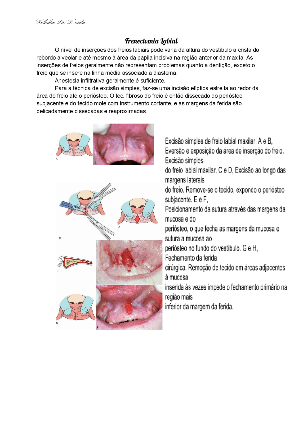 Resumos De Odontologia Graduação Docsity
