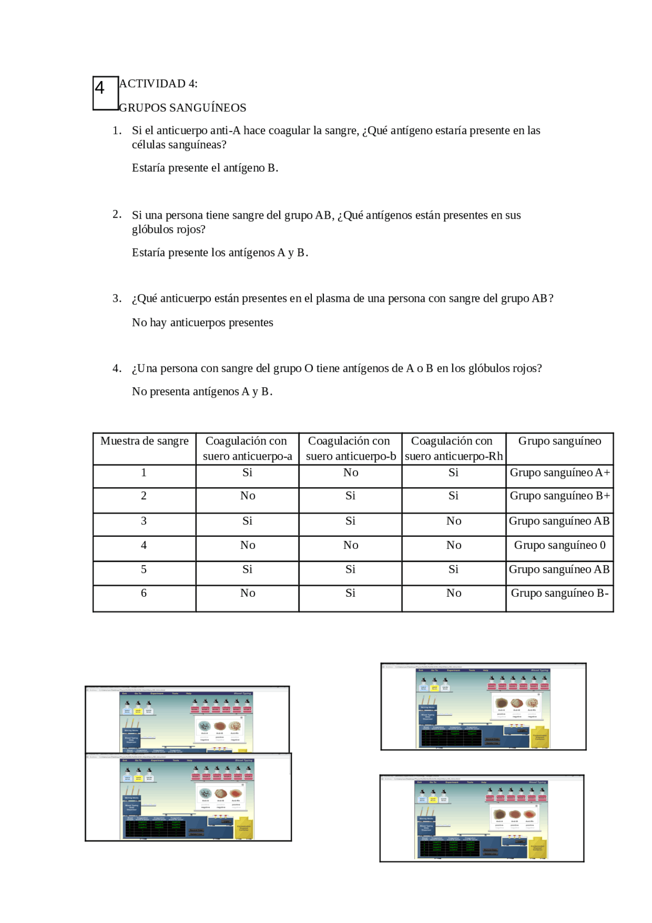 PhysioEx EJERCICIO 11-12 | Ejercicios de Fisiología | Docsity