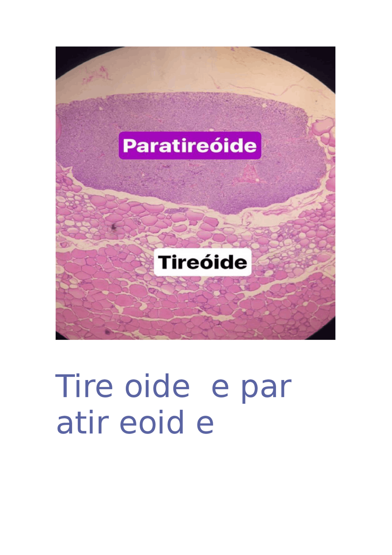 Histologia Da Paratireoide Tireoide