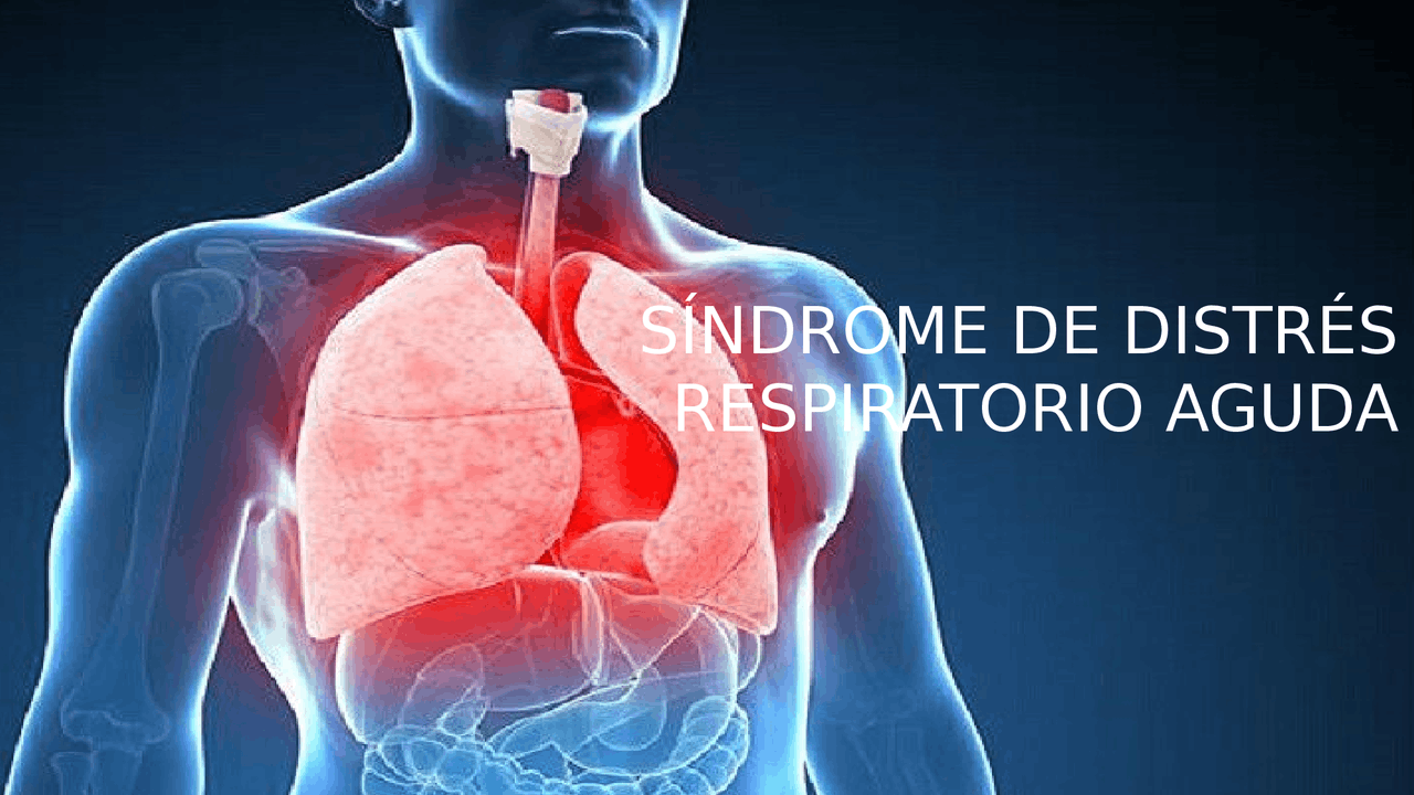 Sindrome De Distres Respiratorio Del Adulto Docsity