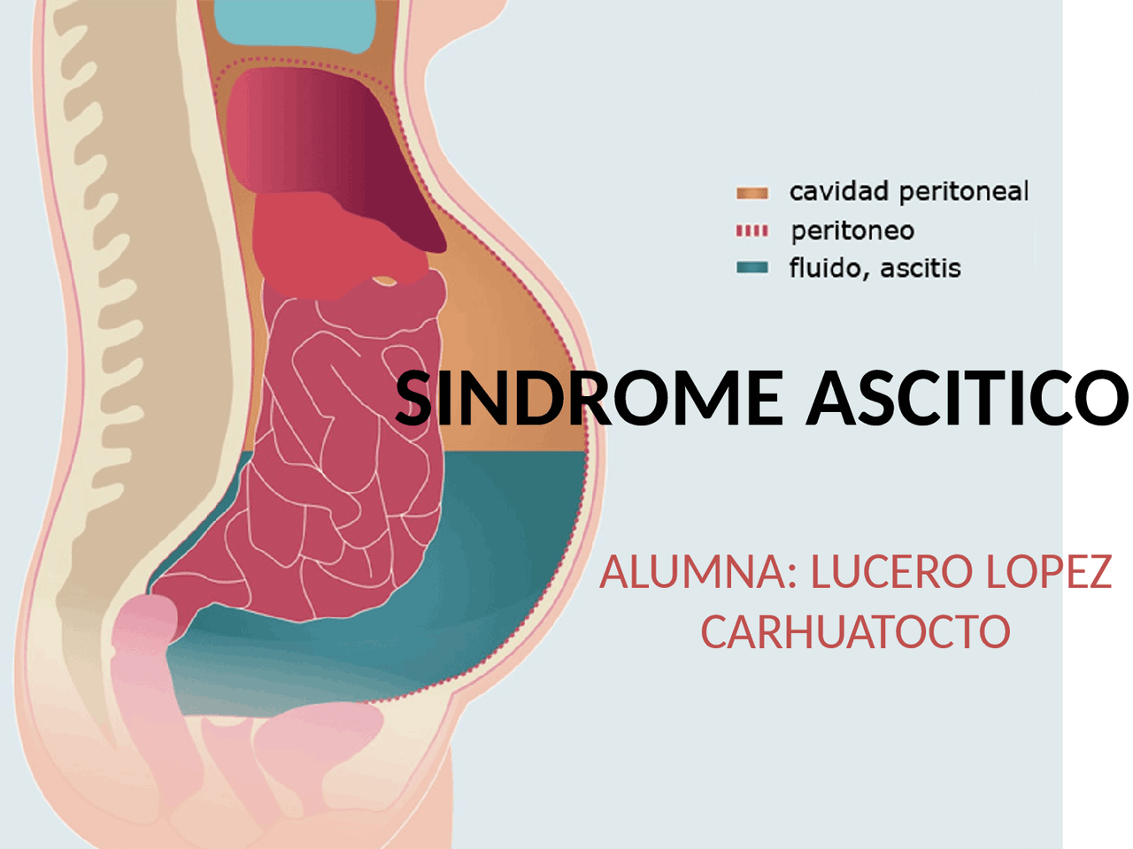 Síndrome ascitico , características - Docsity
