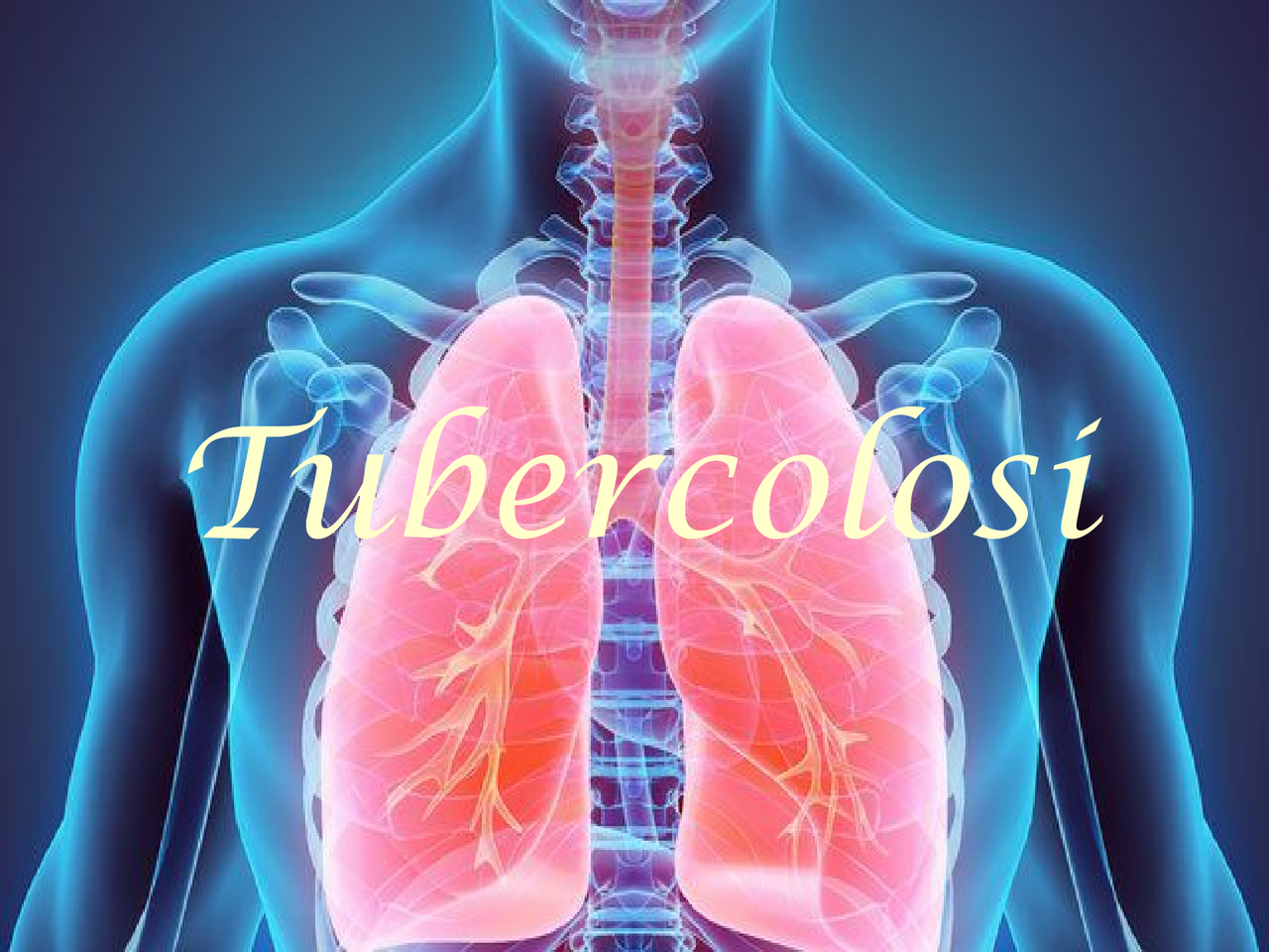 Presentazione sulla tubercolosi - Docsity