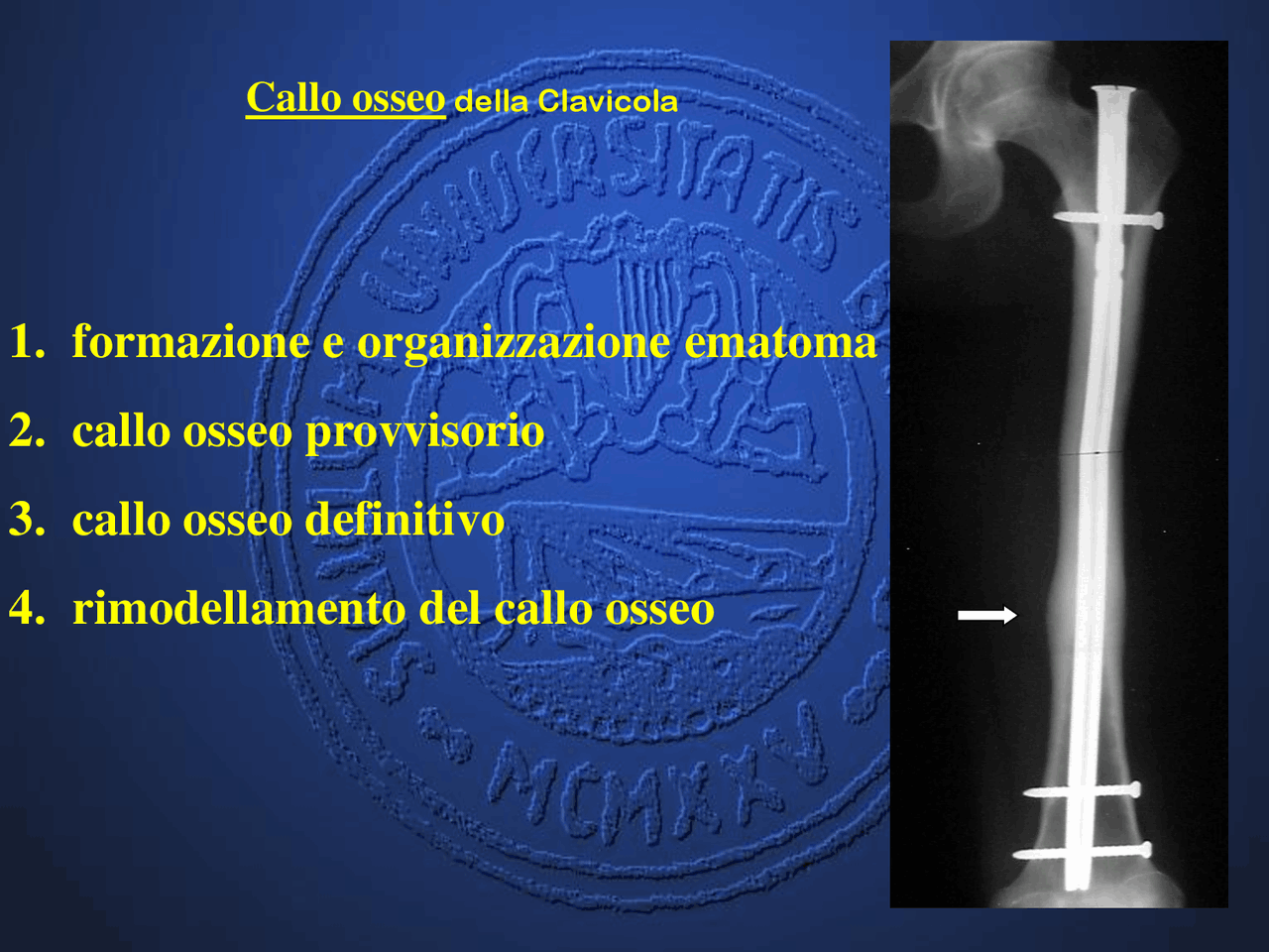 Callo osseo della clavicola - Docsity