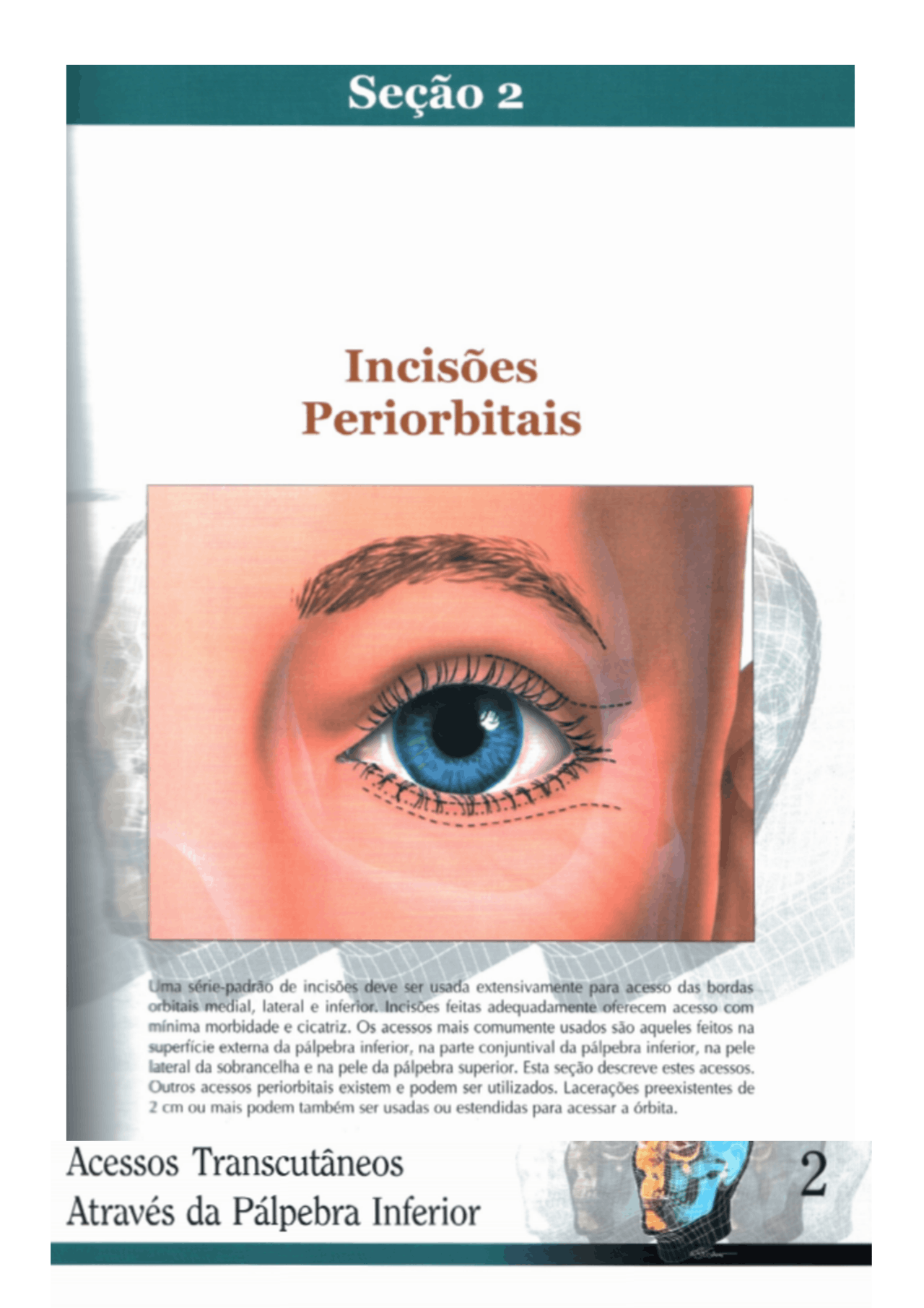 Incisões Periorbitais - Docsity
