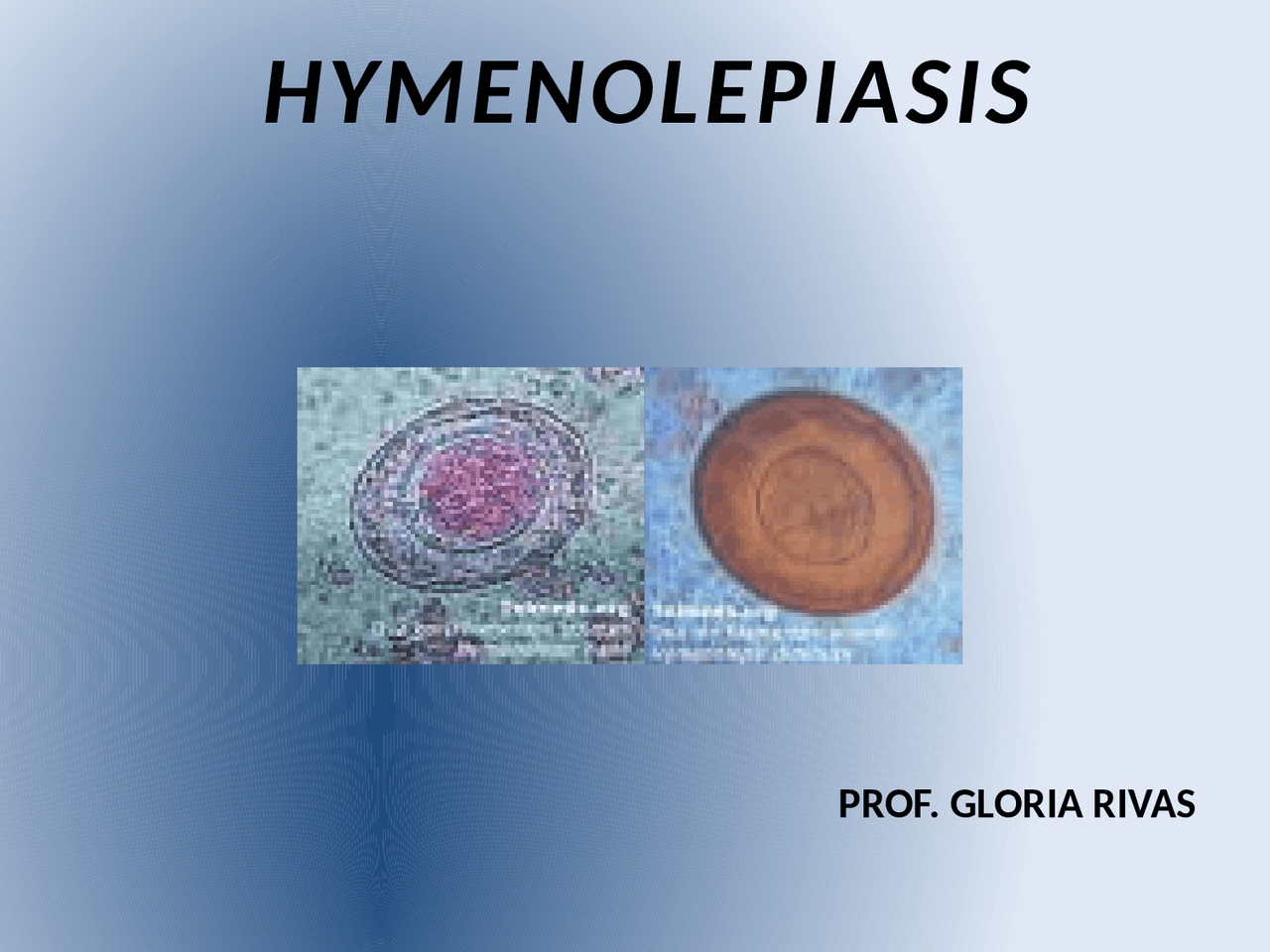 Parasitosis de la hymenolepiasis - Docsity
