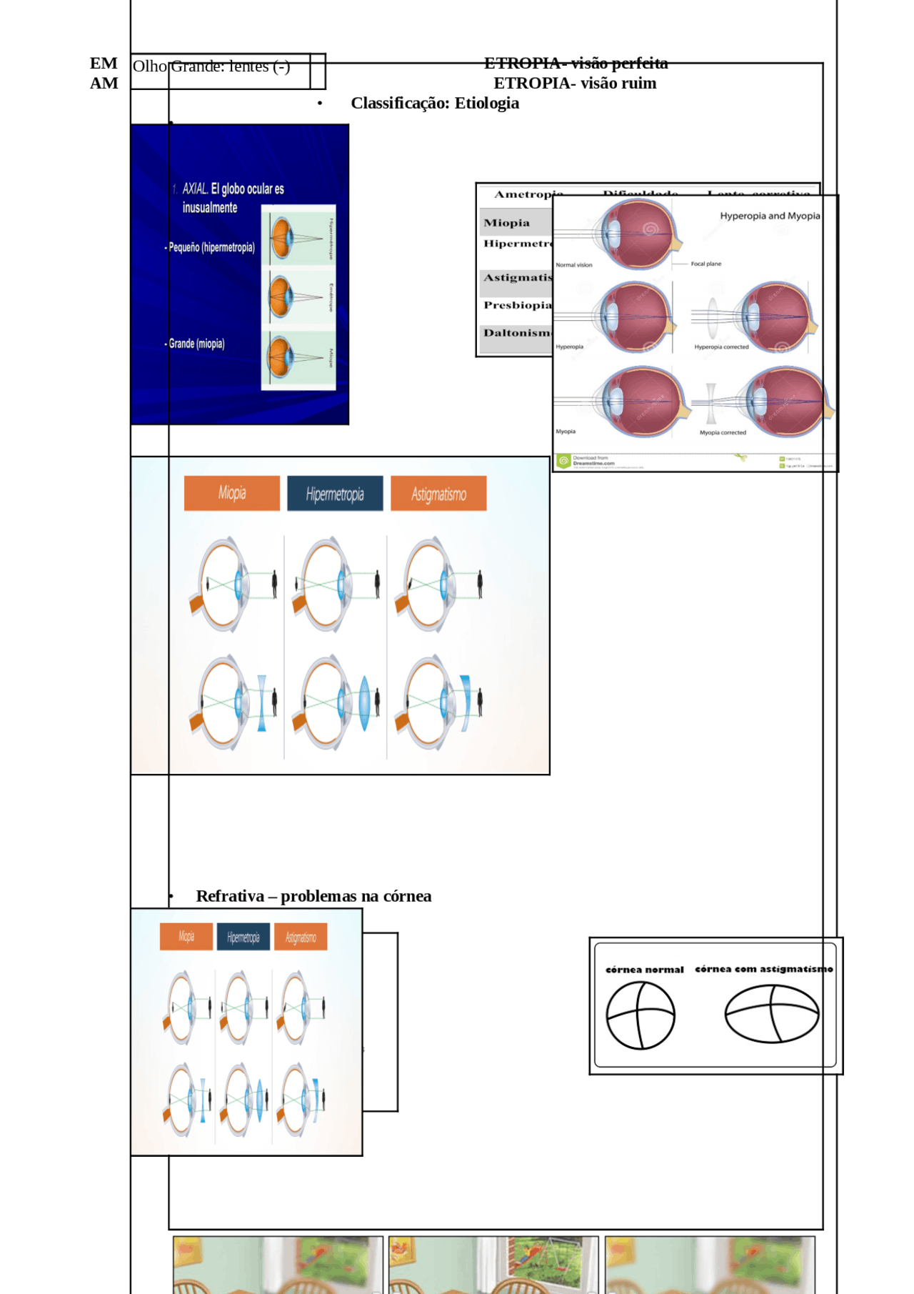 Oftalmologia Resumen Apuntes Clase Emetropia Docsity