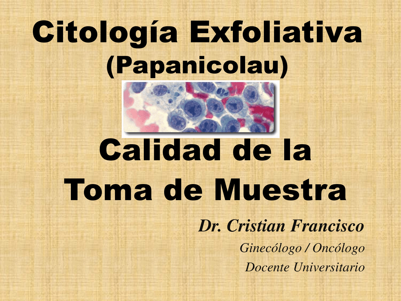 Cancer Cervicouterino Docsity