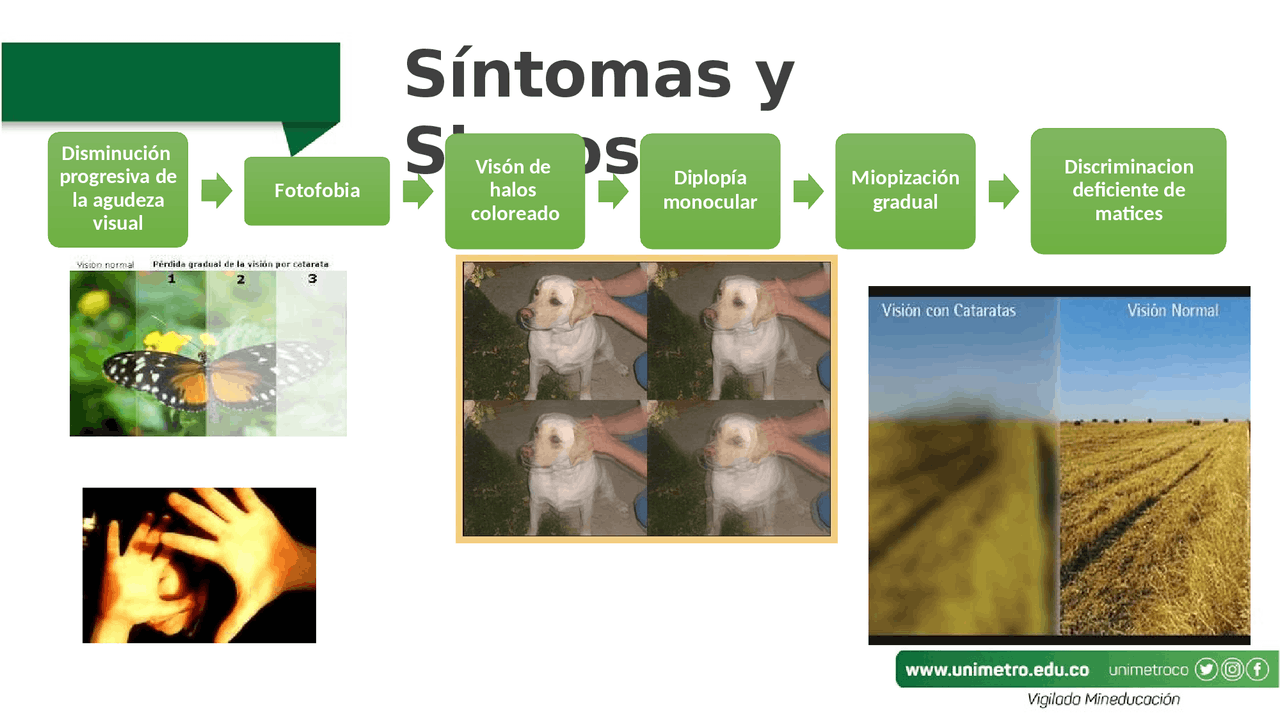 Cataratas Diapositivas De Oftalmología Docsity