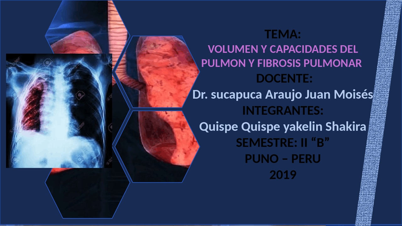Anatomía De Fibrosis Pulmonar Monografías Ensayos De Anatomía Docsity
