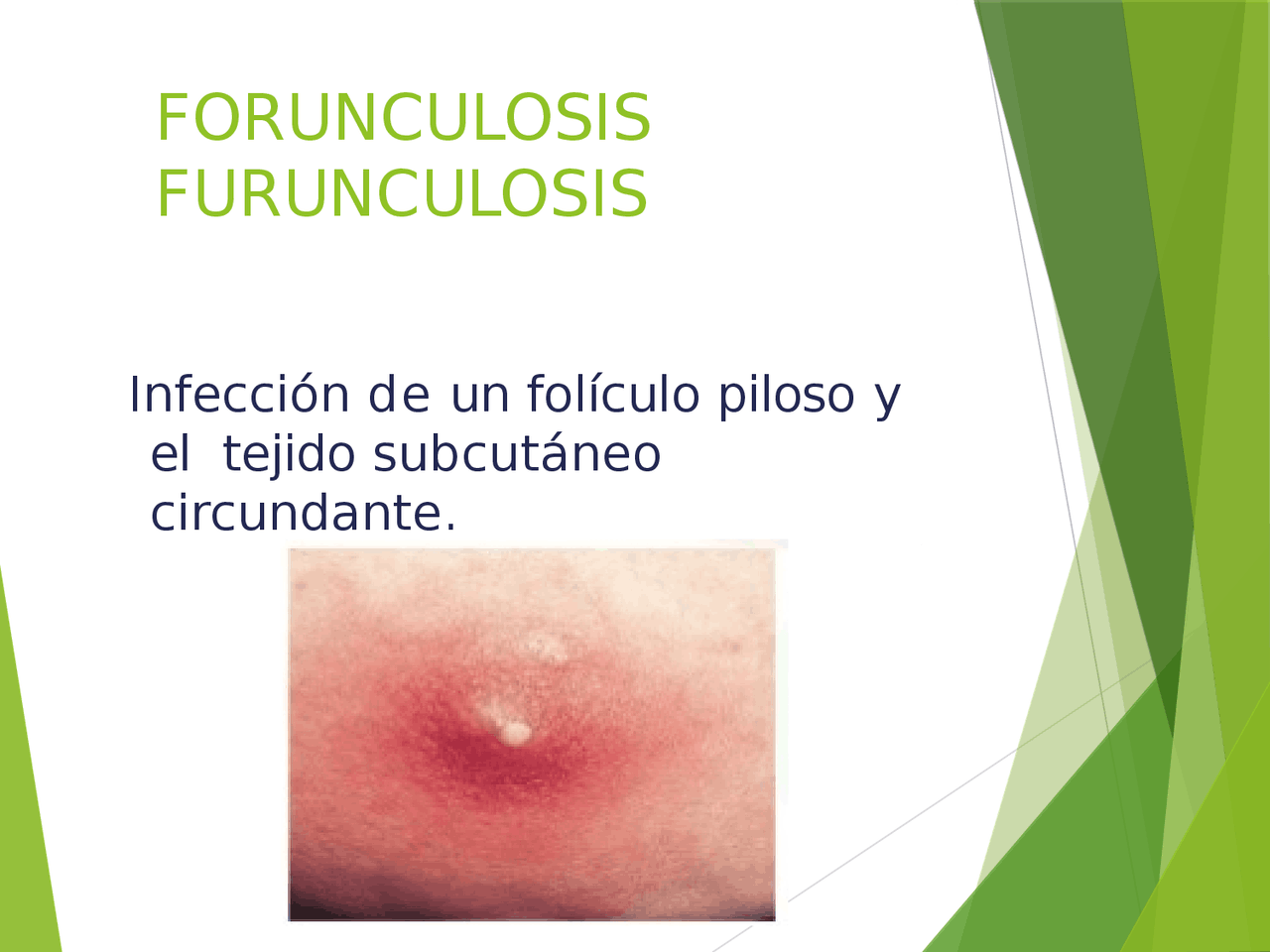 Información básica de forunculosis - Docsity