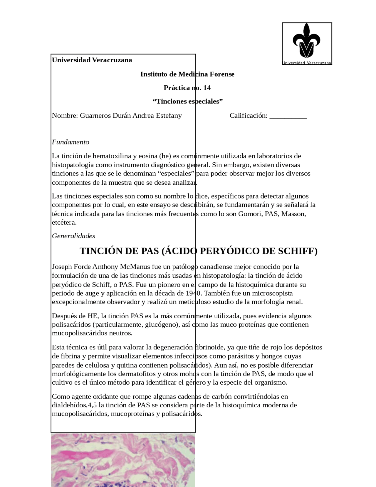 Tinciones Especiales Apuntes De Histología Docsity