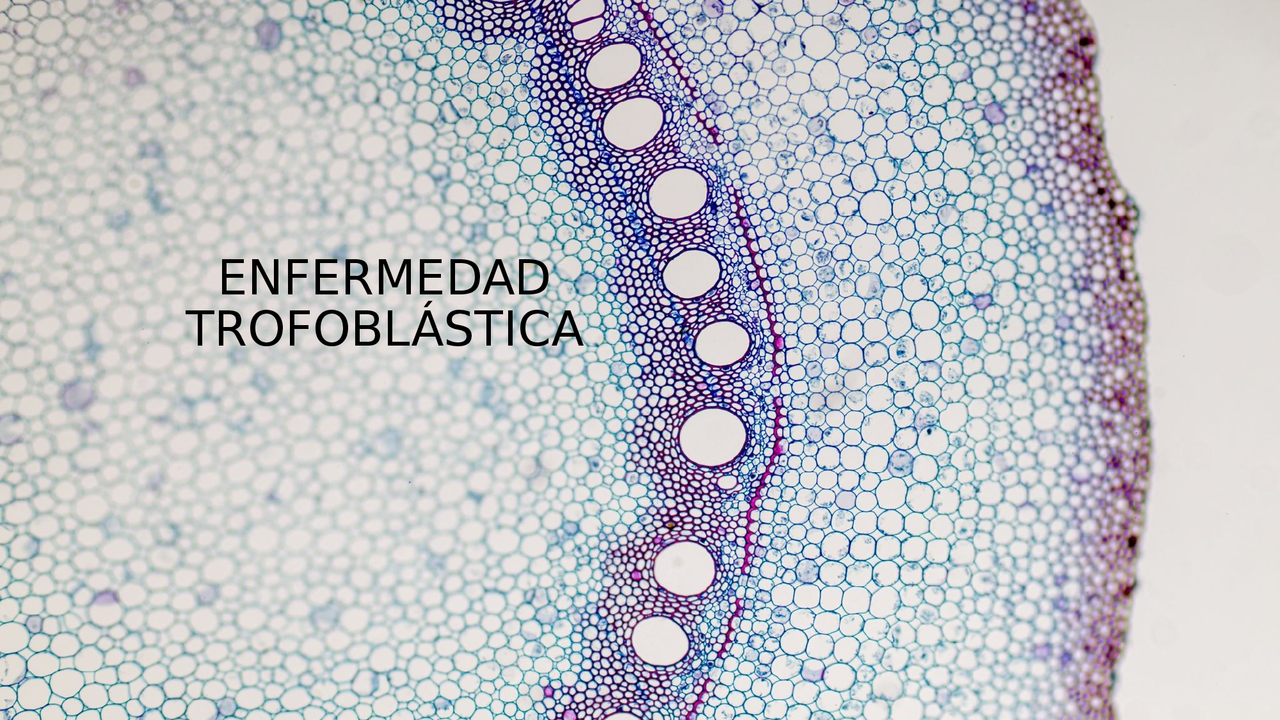 ENFERMEDAD TROFOBLASTICA GESTACIONAL - Docsity