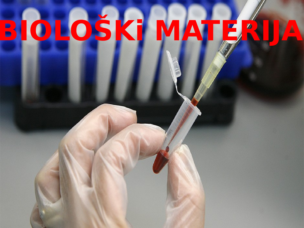 Biološki materijal prezentacija | Slajdovi' predlog Medicinska ...