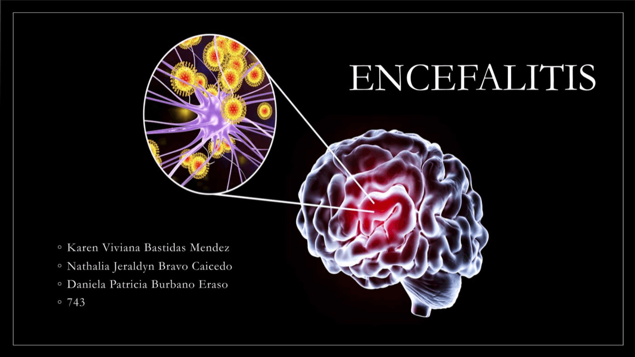 Encefalitis infecciosa en sistema nervioso central - Docsity