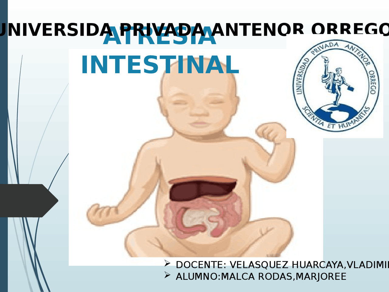 ATRESIAS INTESTINALES - Docsity