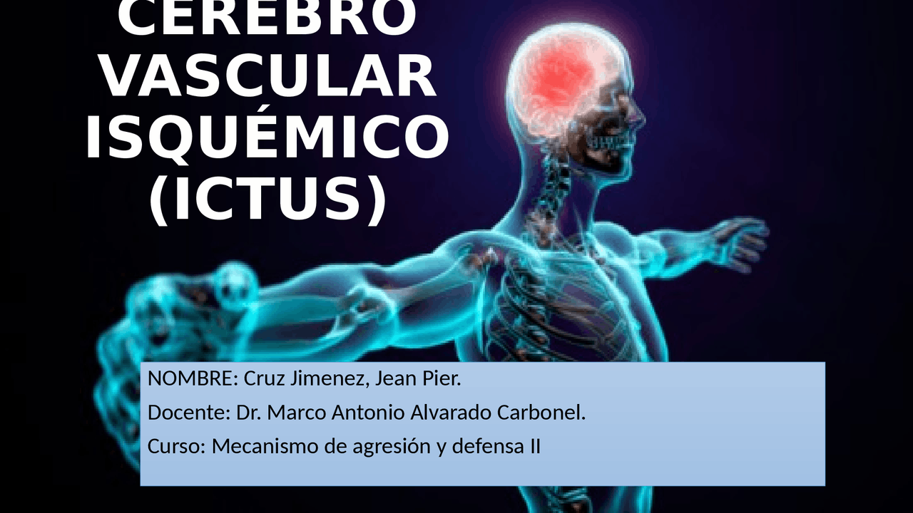 Enfermedad cerebro vascular Isquemico - Docsity