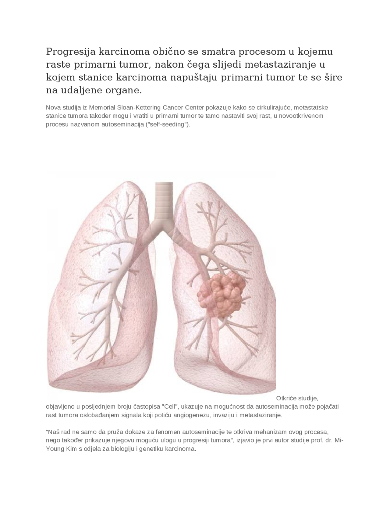Progresija malignih tumora | Skripte' predlog Genetika - Docsity