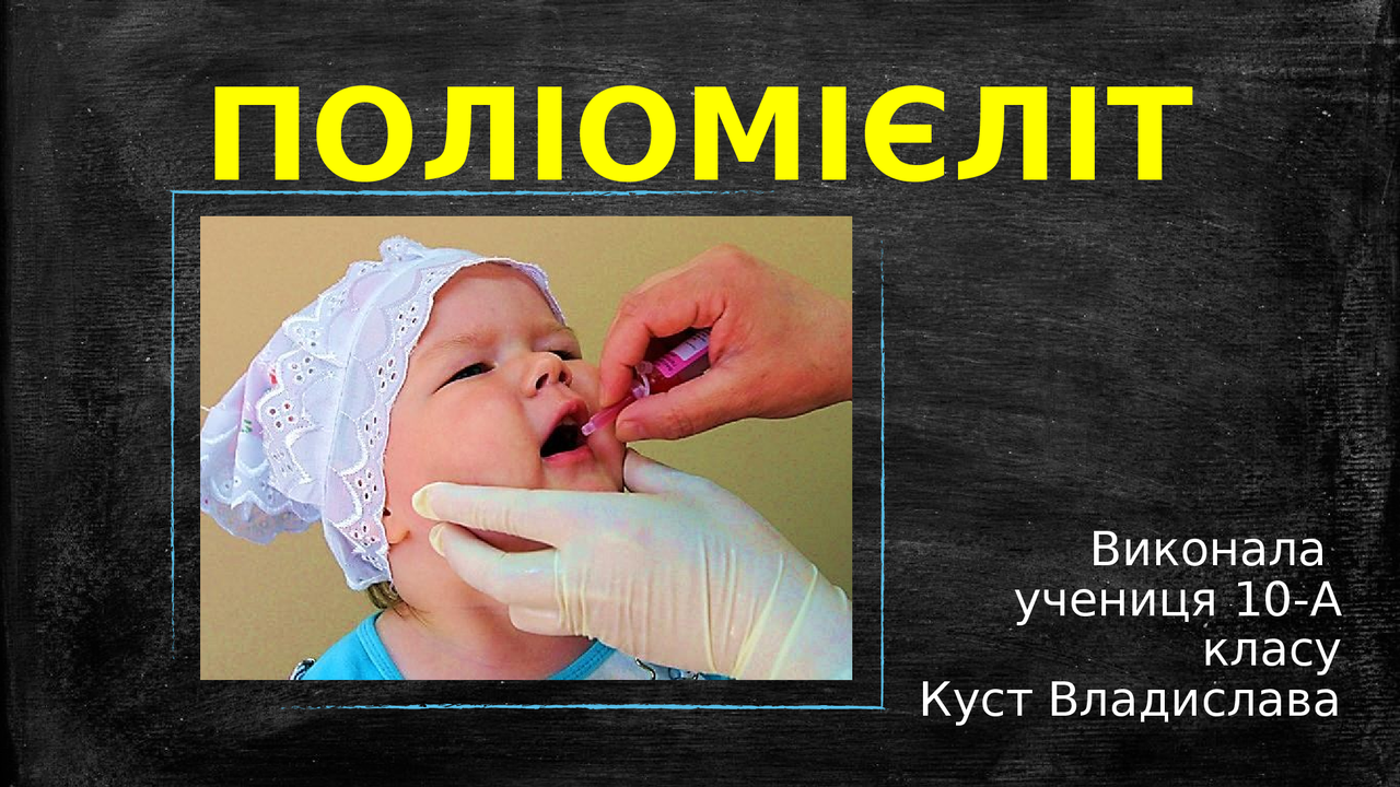 Презентация о полиомиелите его развитии и лечении Docsity