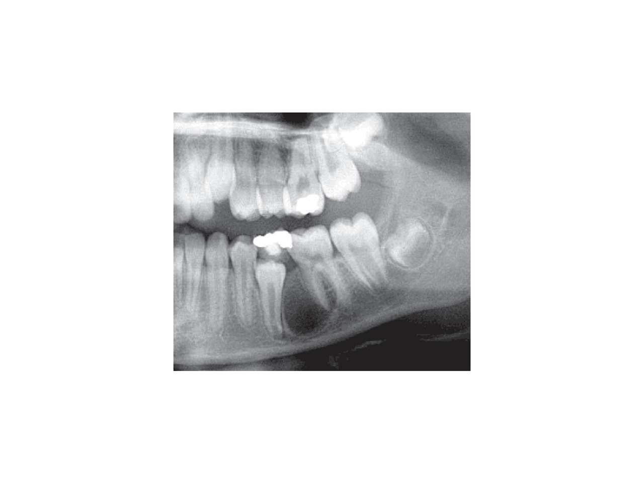 Dental lesions radiography | Lecture notes Radiology | Docsity