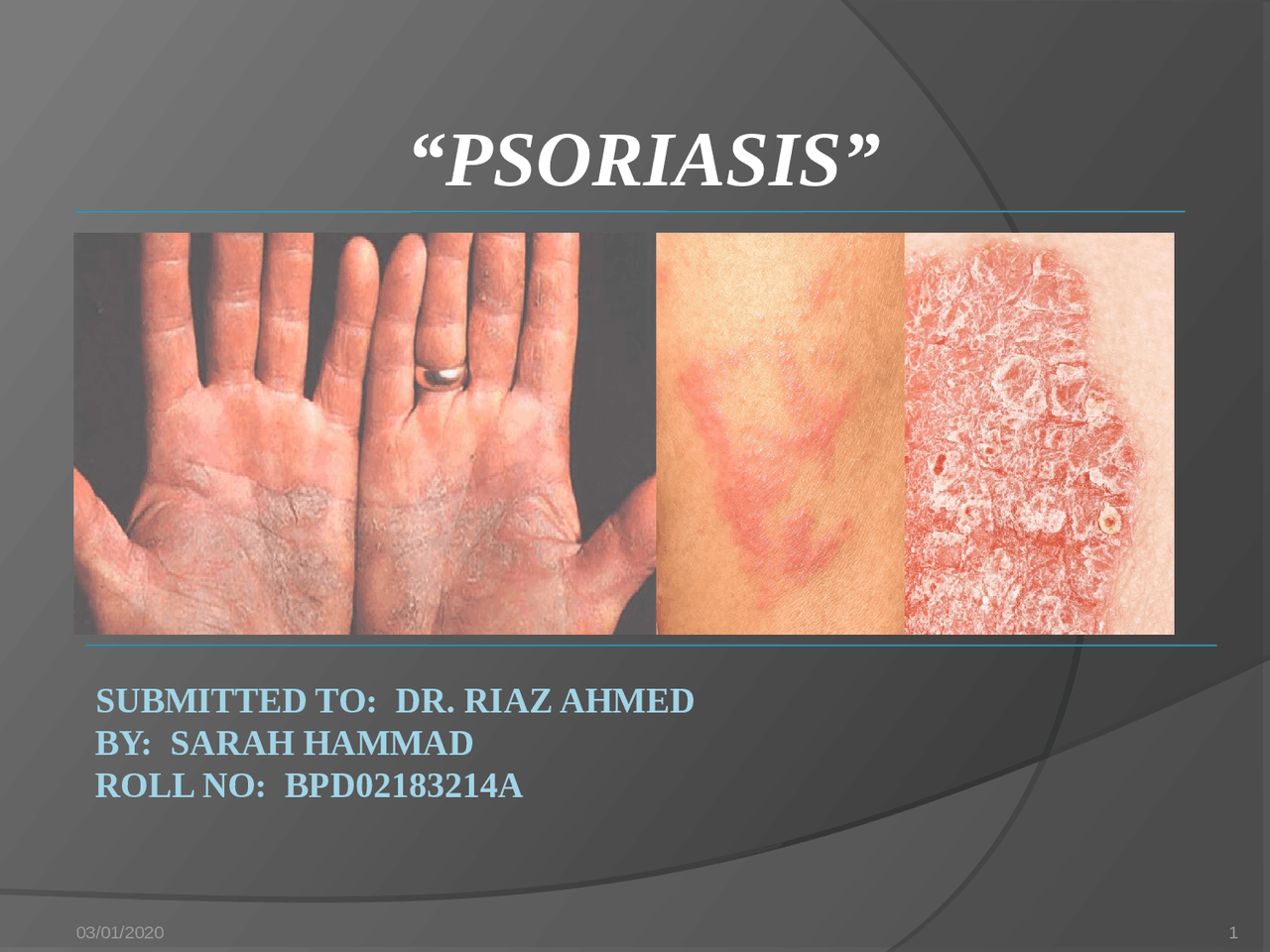 What is Psoriasis and its main types ? - Docsity