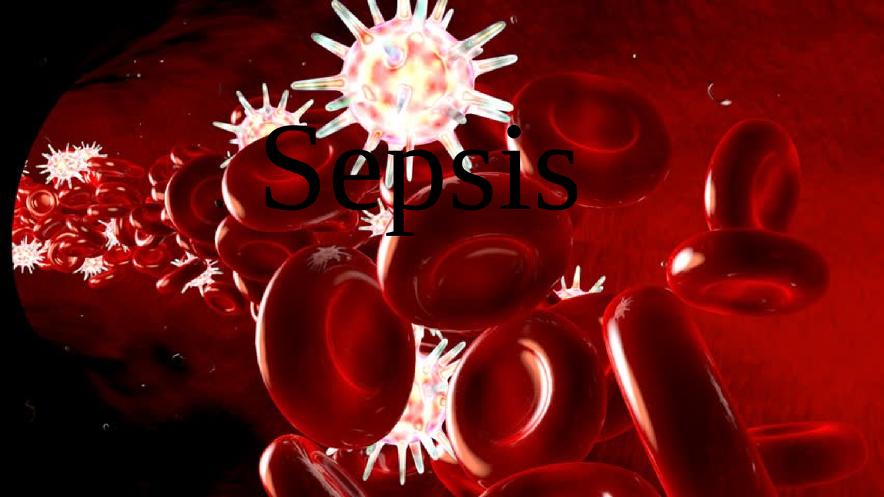 Sepsa: definicija, uzroci, klinička slika, simptomi i terapija ...