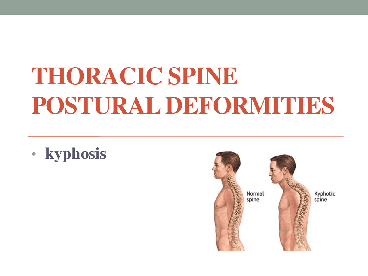 Posture deformity and correcting them | Lecture notes Clinical Medicine ...
