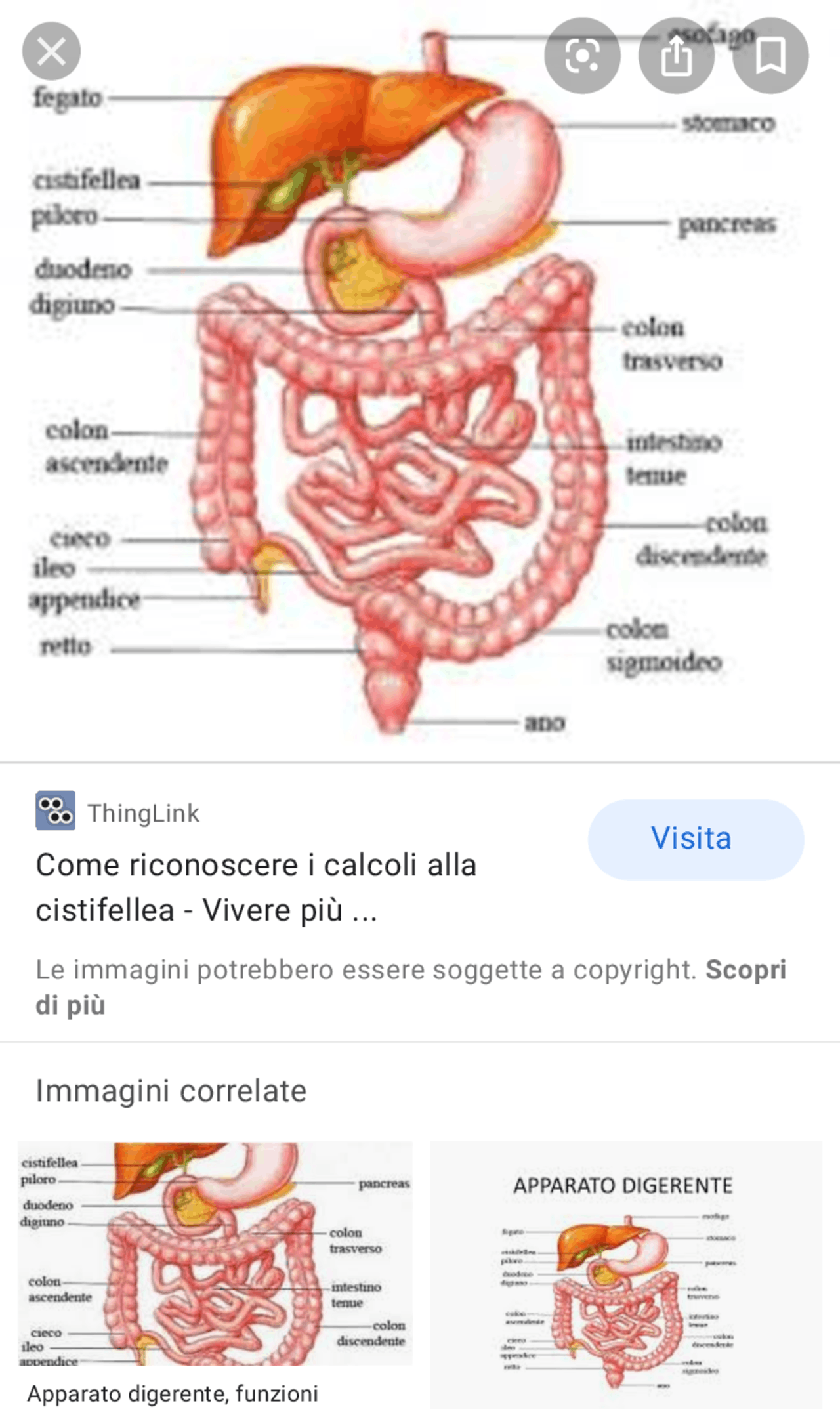 Intestino tenue appunti | Dispense di Anatomia | Docsity