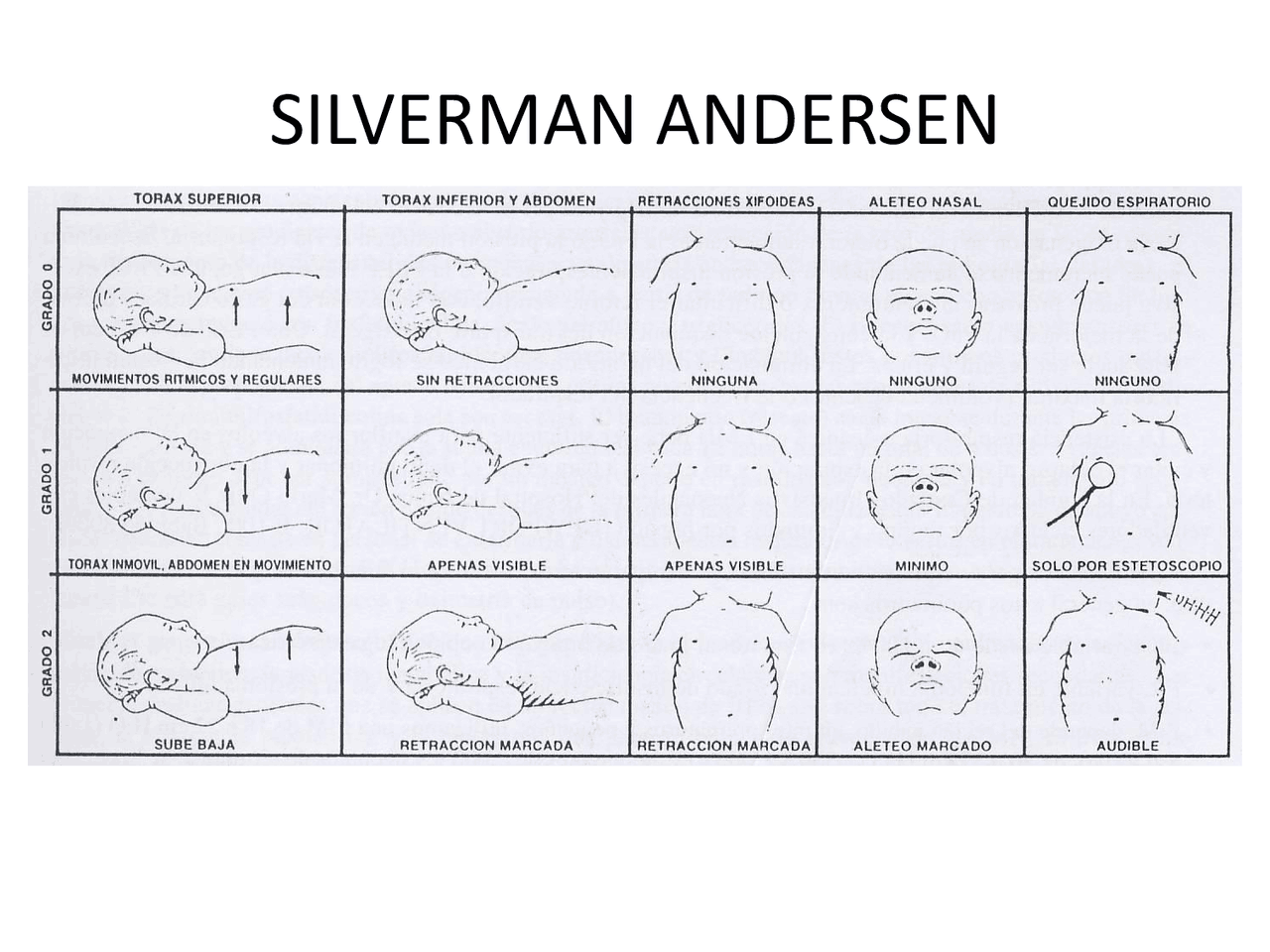 SILVERMAN ANDERSEN NEONATOLOGIA - Docsity