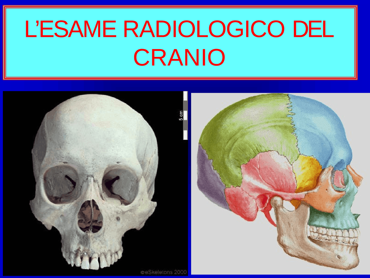 Cranio anatomia radiologica - Docsity