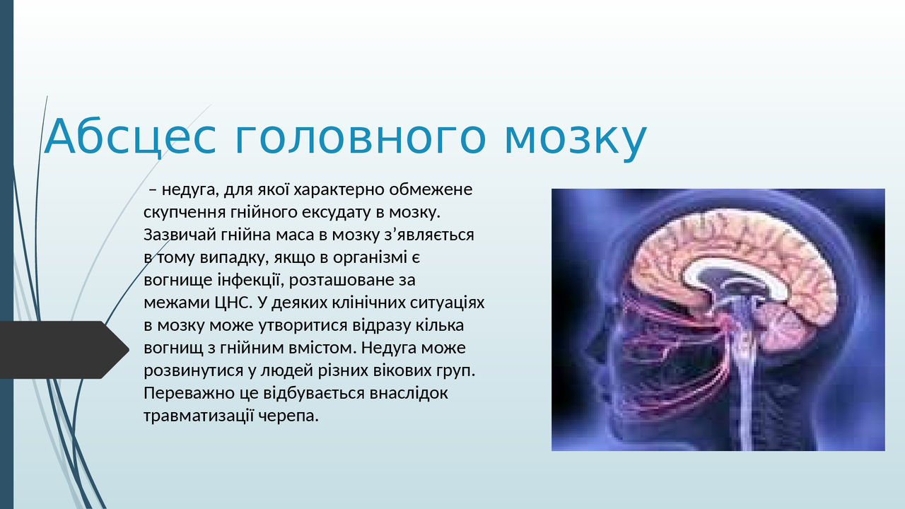 Абсцес головного мозку Docsity