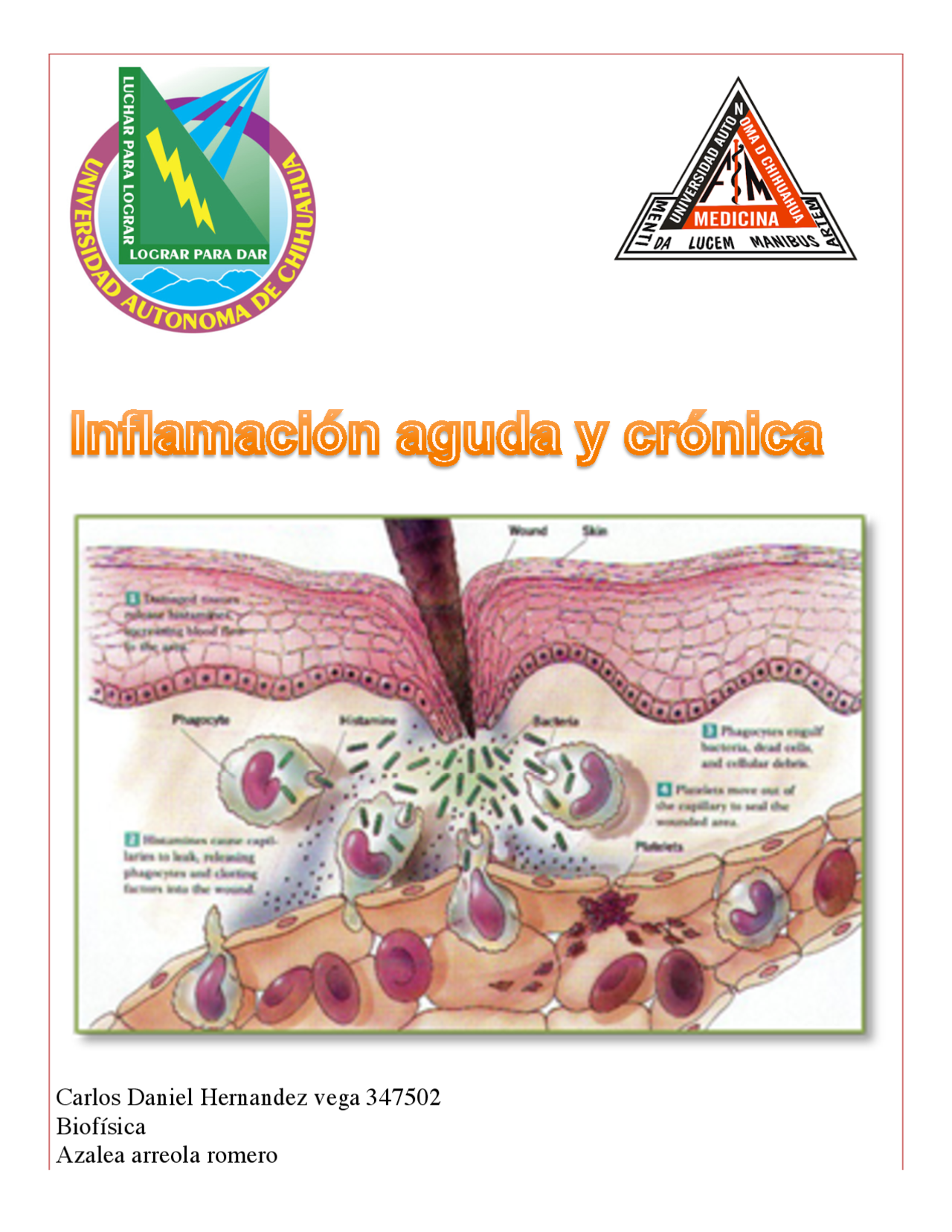 Inflamacion aguda y cronica - Docsity