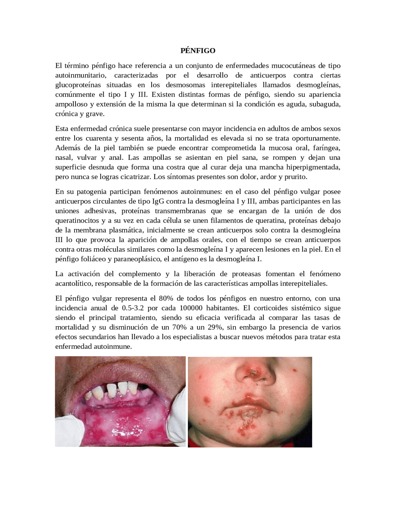 Pénfigo: Fisiopatologia y tratamiento - Docsity