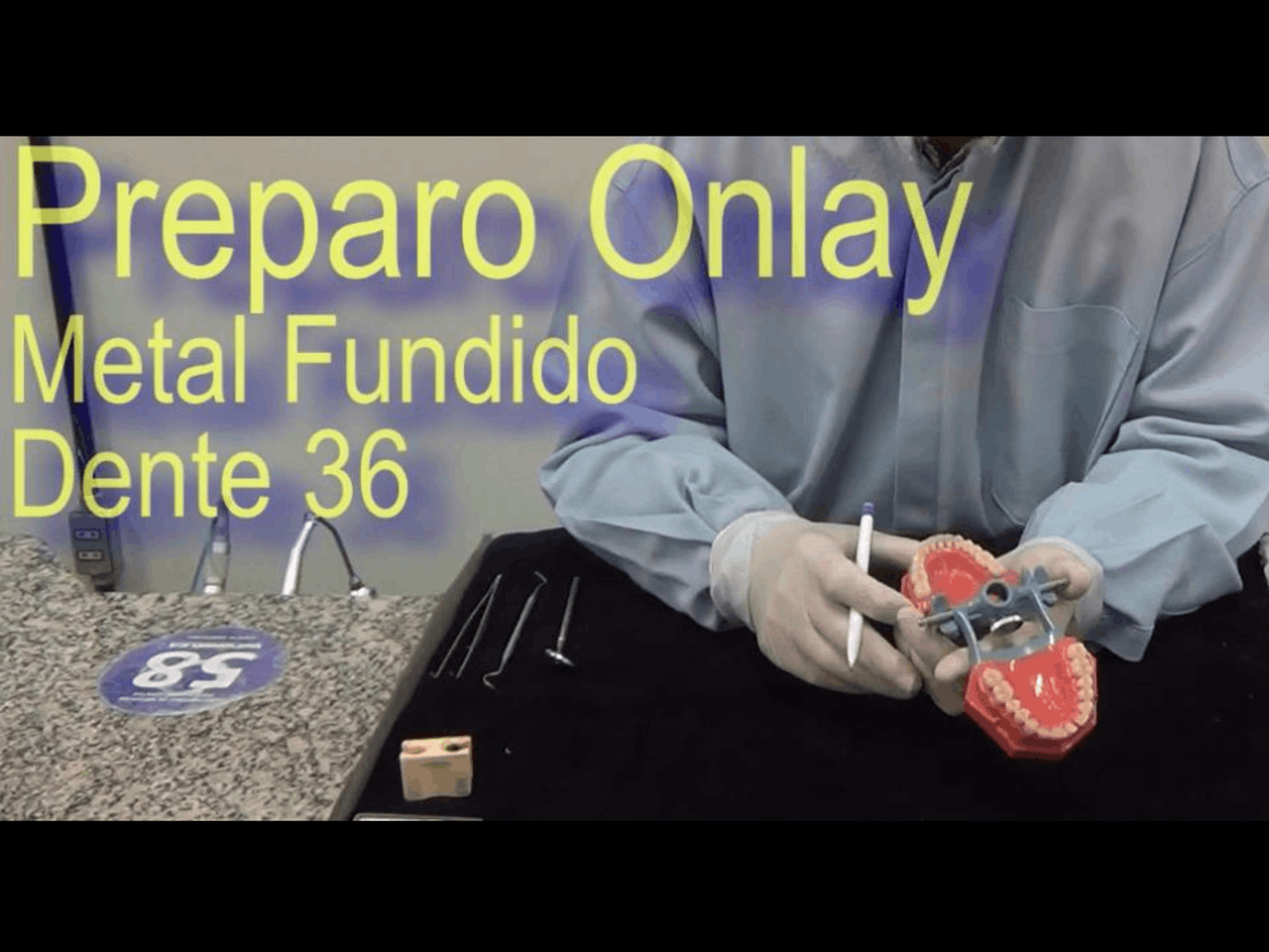 Prótese Fixa, preparo onlay posterior - Docsity