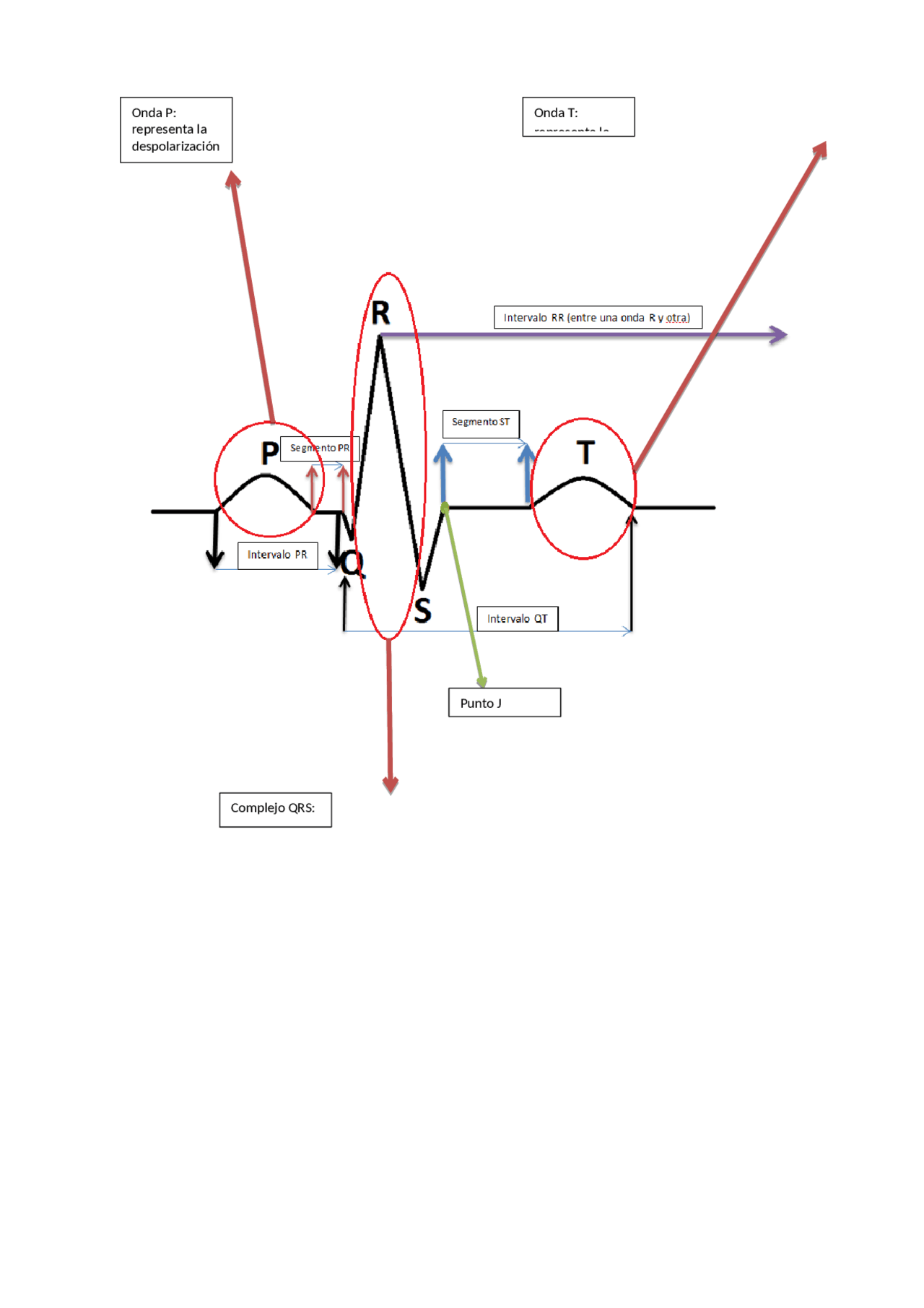 Dibujo explicativo del complejo QRS - Docsity
