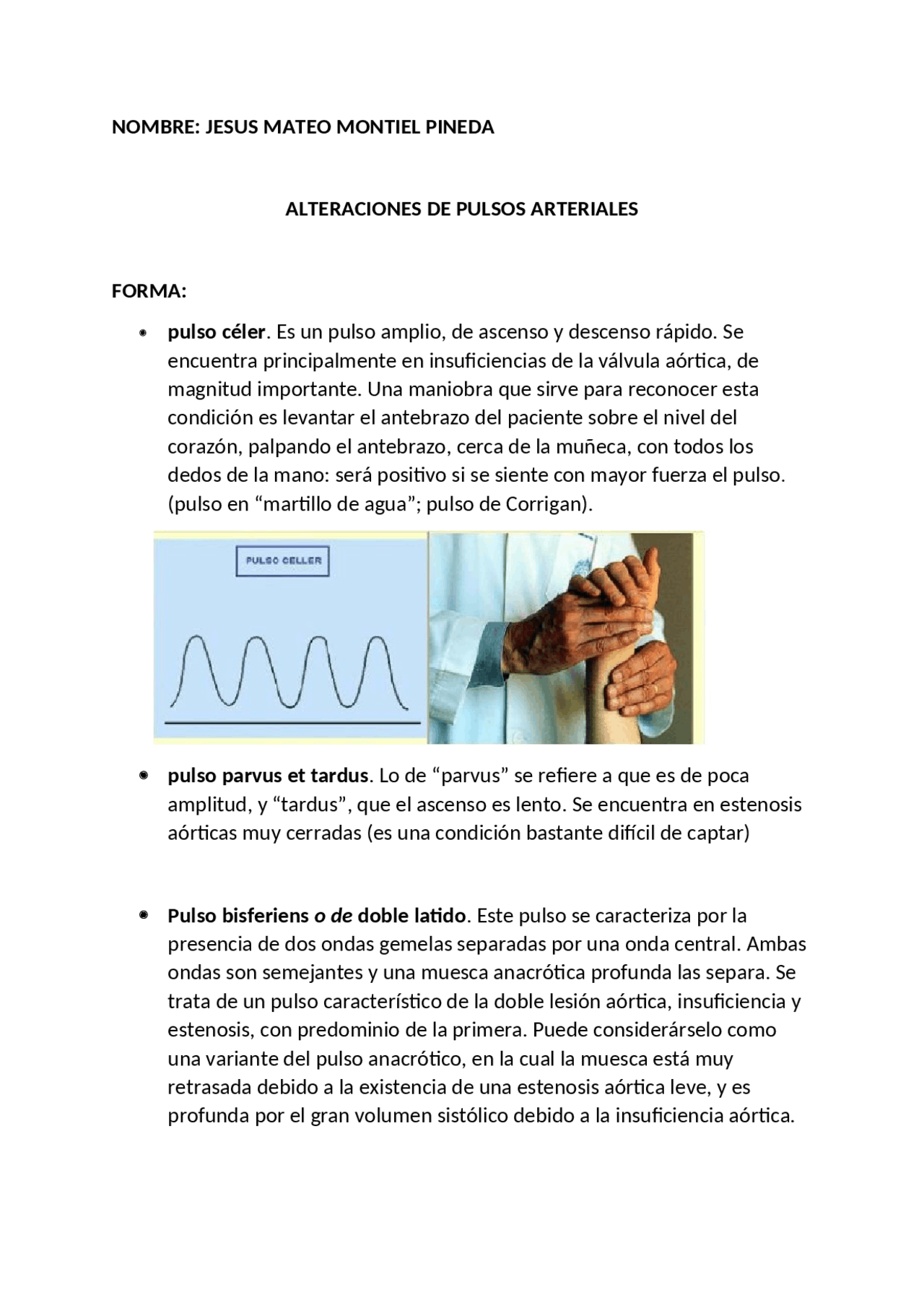 Tipos de pulso y las características de cada uno | Apuntes de ...