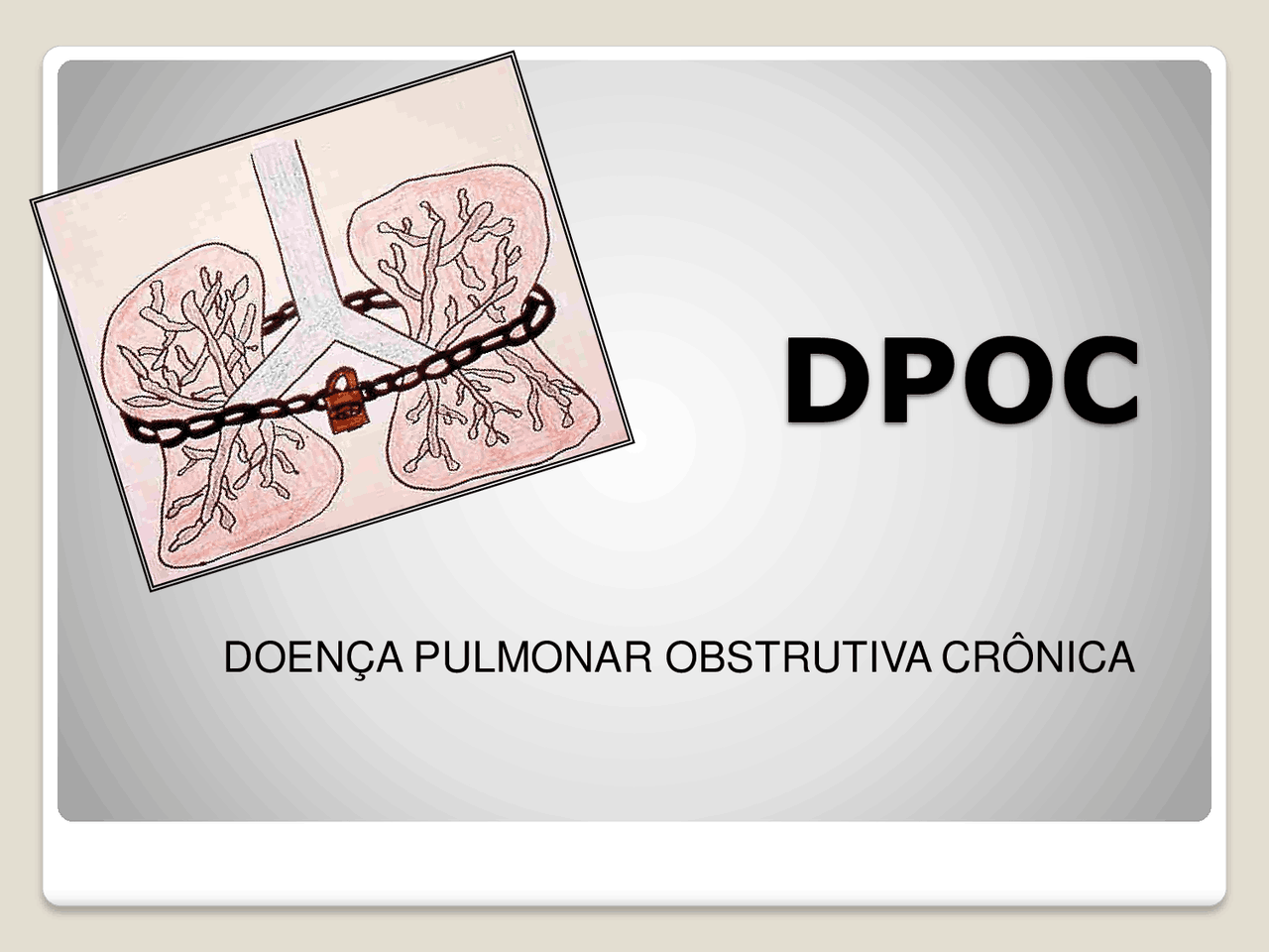 Doença Pulmonar Obstrutiva Crônica - DPOC - Docsity