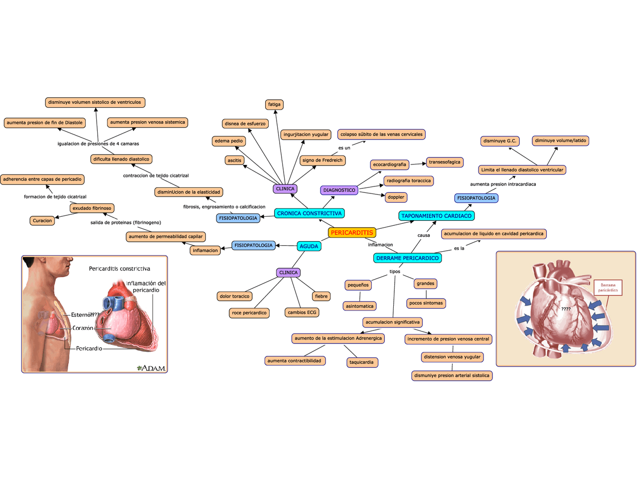 Pericarditis Mapa conceptual - Docsity