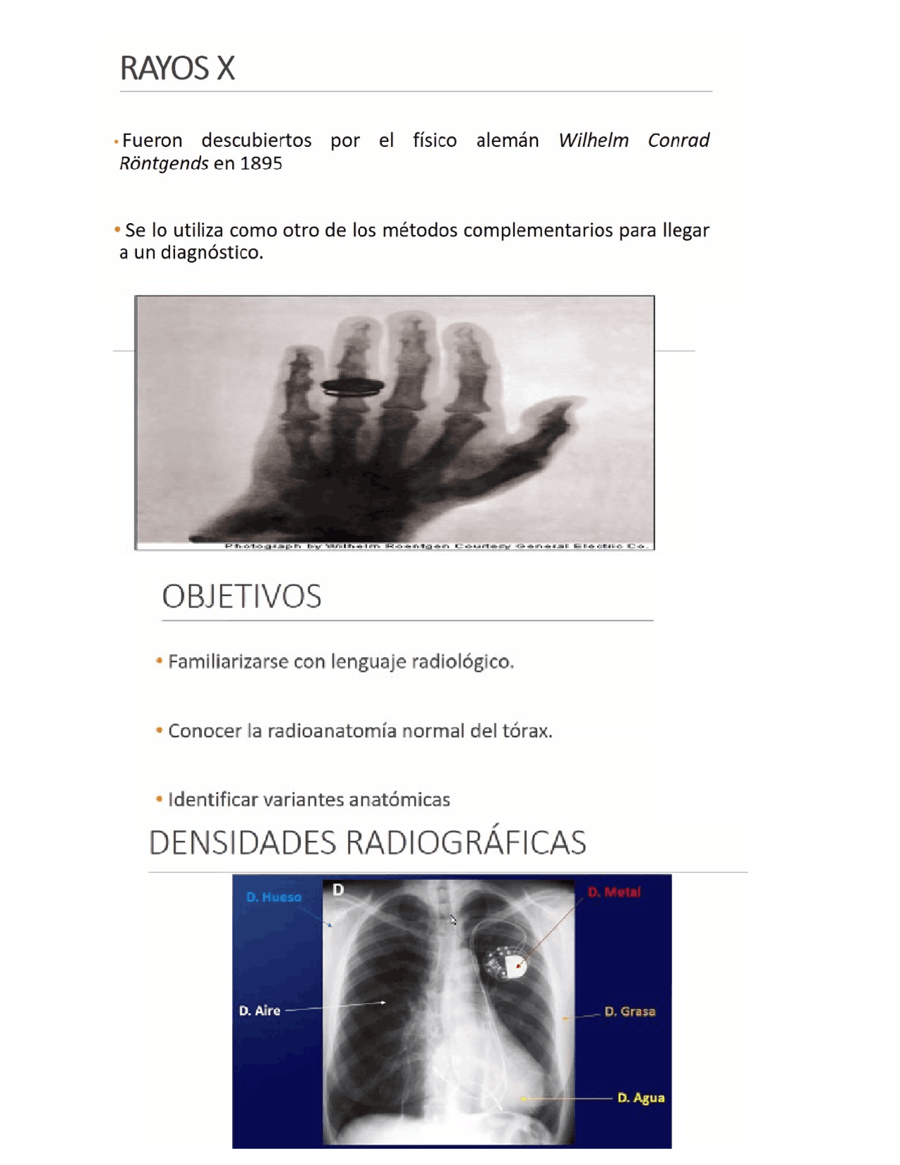 RX torax anatomía radiologíca - Docsity